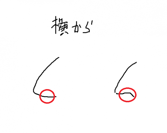 鼻中隔延長術におけるcolumella show - 【名医選び】失敗しないための美容相談所・山口